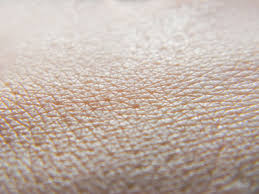 Progressive skin fibrosis is associated with a decline in lung function ...