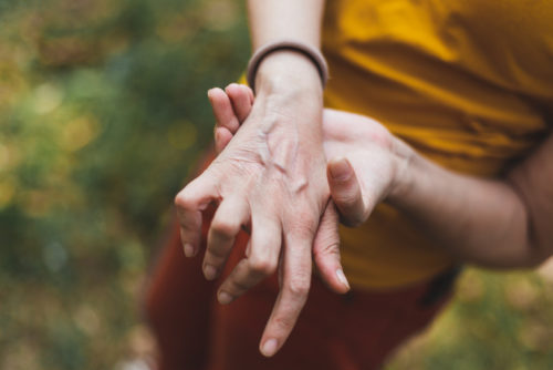 Beperkte waarde CRP bij artritis psoriatica | mediamed