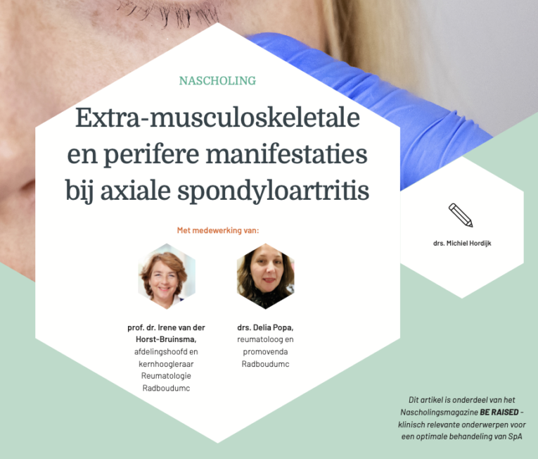 Extra-musculoskeletale en perifere manifestaties bij axiale ...